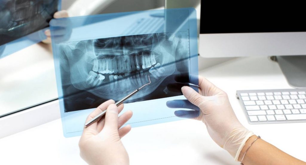 Snimanje zuba Podgorica | Ortopan i RTG snimak | Dr Filimanović